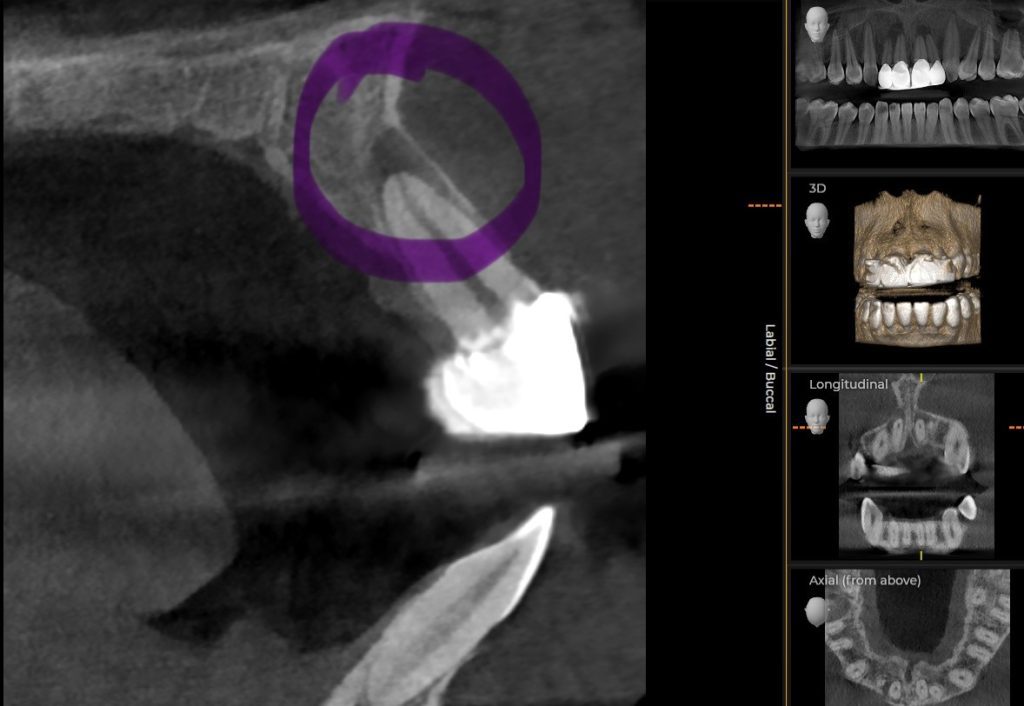 Dental Guides | Optimal Dental Health